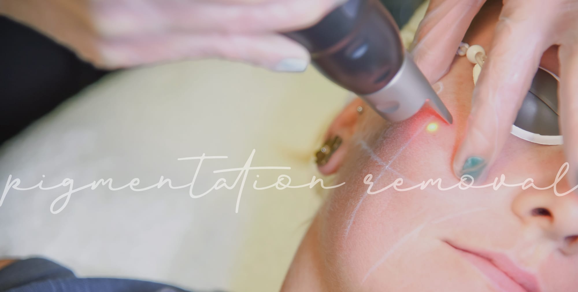 Pigmentation Removal - Ottawa Laser ClinicOttawa Laser Clinic