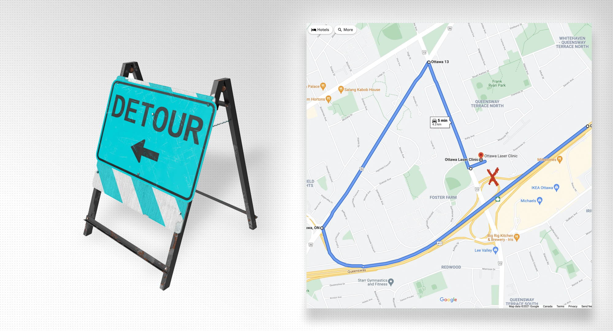 Detour Sign & Map - Ottawa Laser ClinicOttawa Laser Clinic